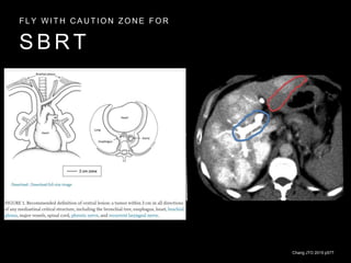 SBRT benefits and toxicities | PPT