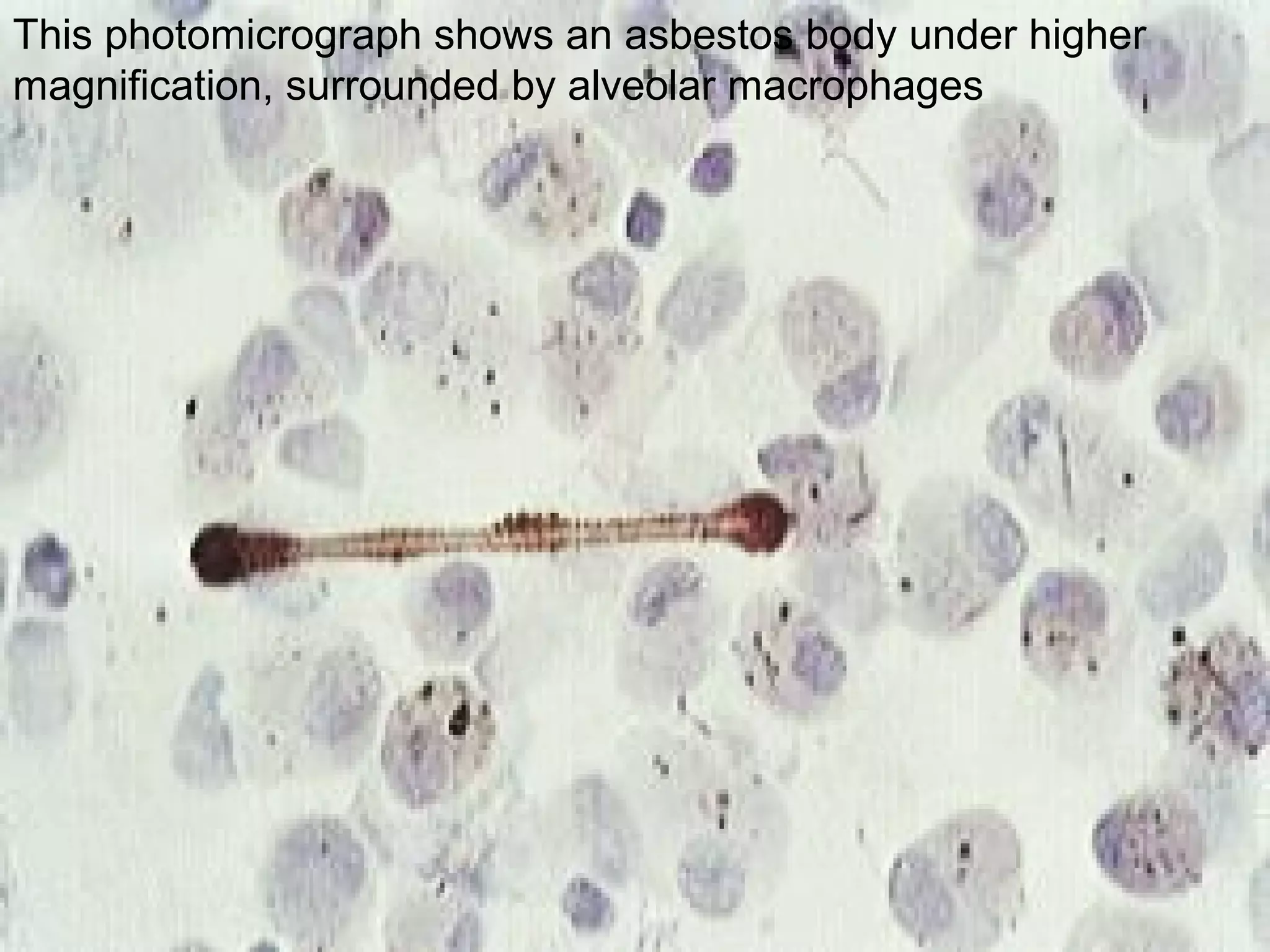 Bal fluid analysis | PPT