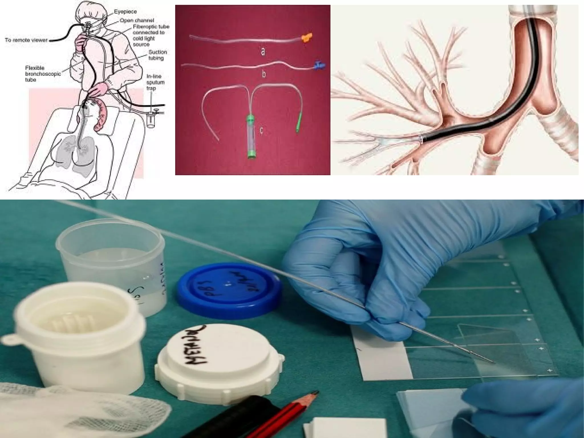 Bal fluid analysis | PPT