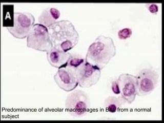 Bal fluid analysis | PPT