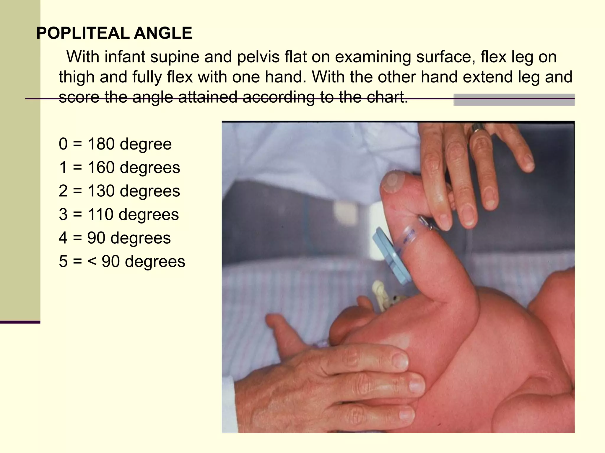 SCORING-BALLARDS.ppt.pdf