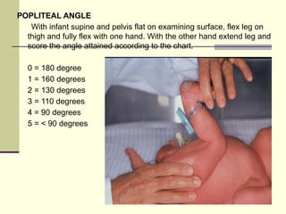 SCORING-BALLARDS.ppt.pdf