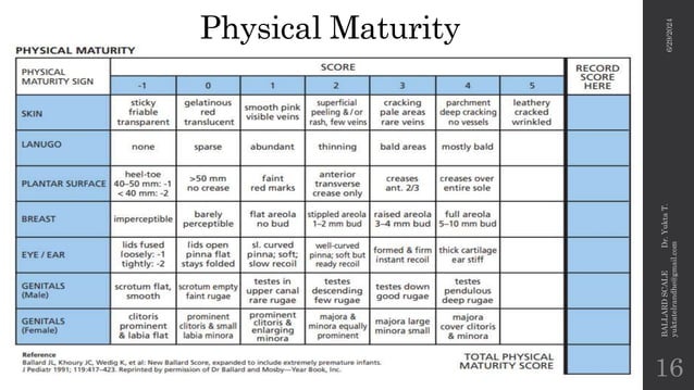 BALLARD SCALE Maturational assessment of gestational age .pptx