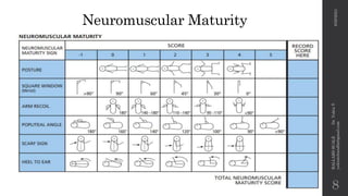 BALLARD SCALE Maturational assessment of gestational age .pptx