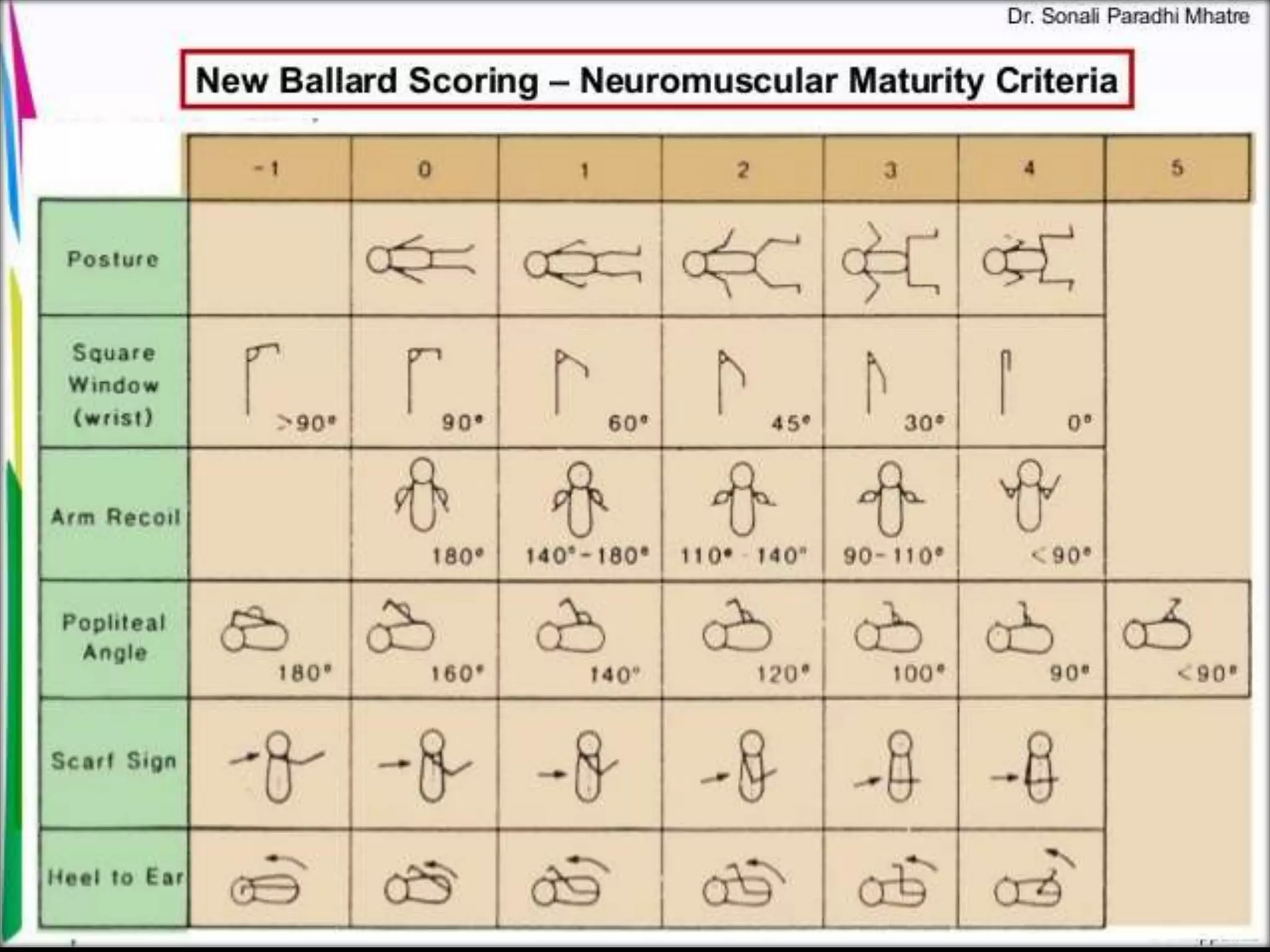 Ballard scale presentation | PPTX