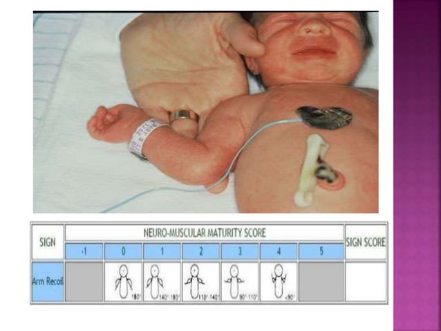 Ballard scale presentation | PPTX | Pregnancy | Reproductive Health