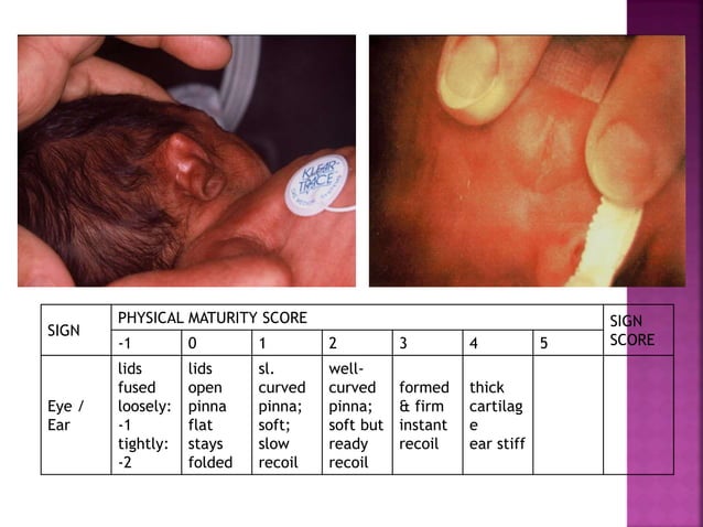 Ballard scale presentation | PPTX | Pregnancy | Reproductive Health