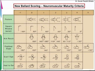 Ballard scale presentation | PPT
