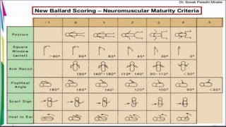 Ballard Score | PPTX
