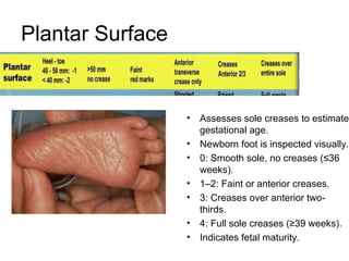 BALLARD SCORING AND INTERPRETATION ON PHYSICAL AND NEURO MATURITY | PPT