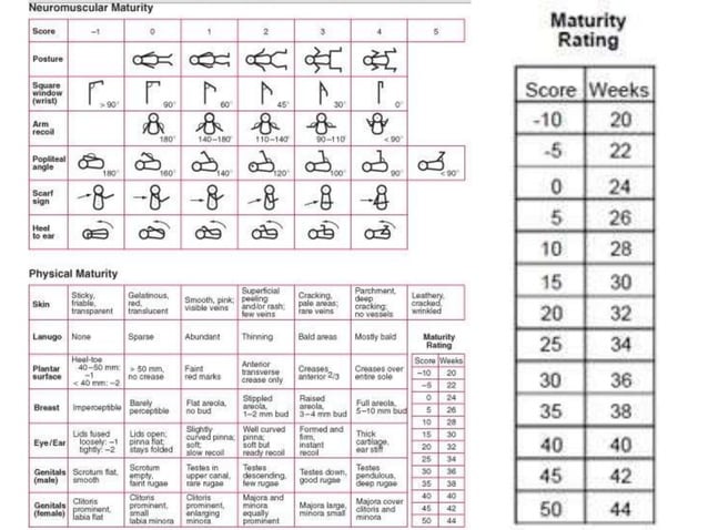 Ballard score.. - Dr Padmesh - Neonatology | PPT