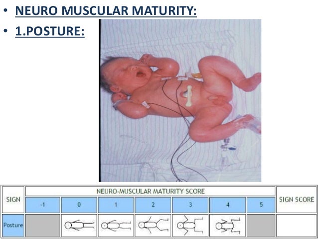 Ballard score.. Dr Padmesh