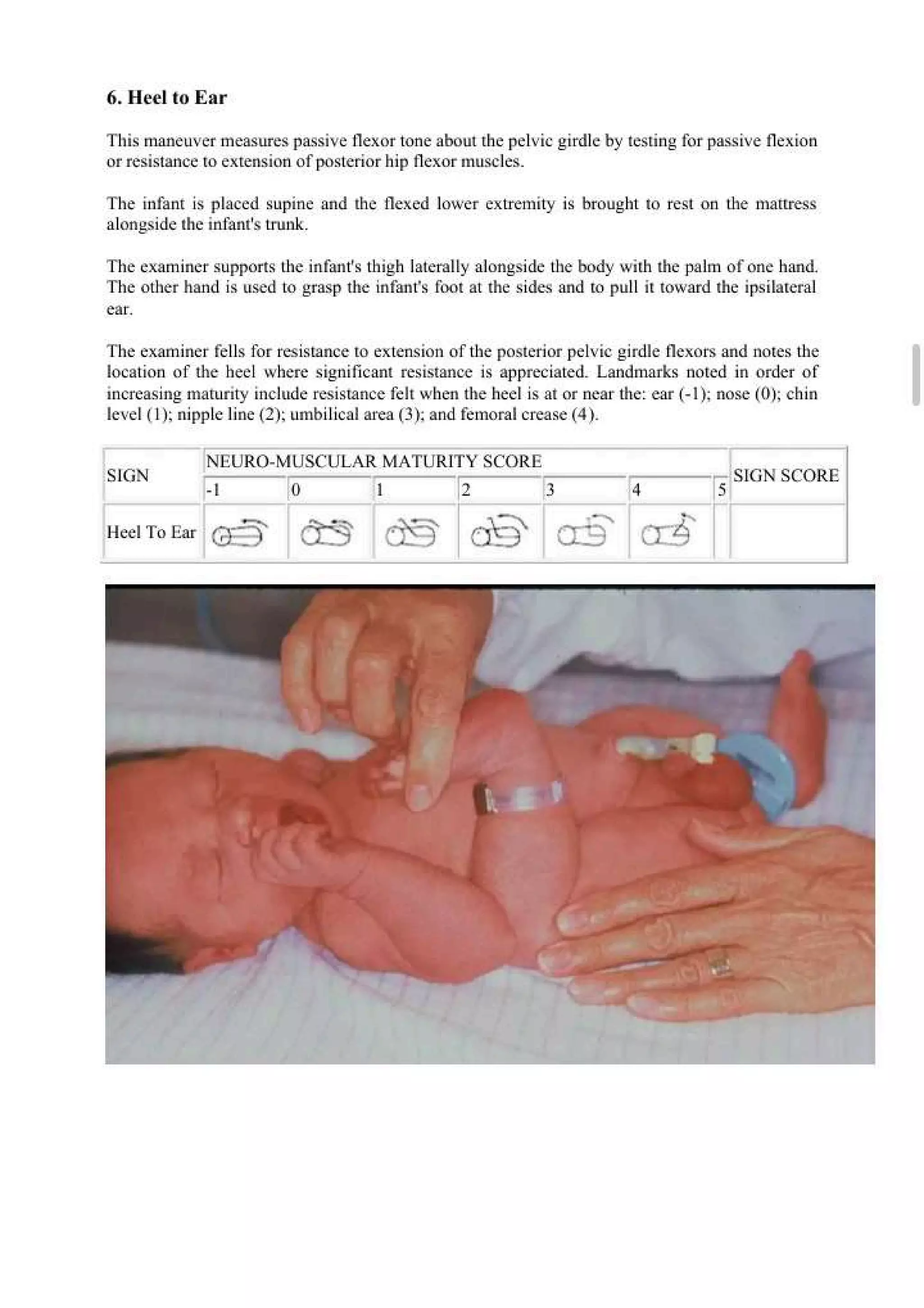 Kenneth Anaeto Nwankwo_Presentation_Ballard Score | PDF