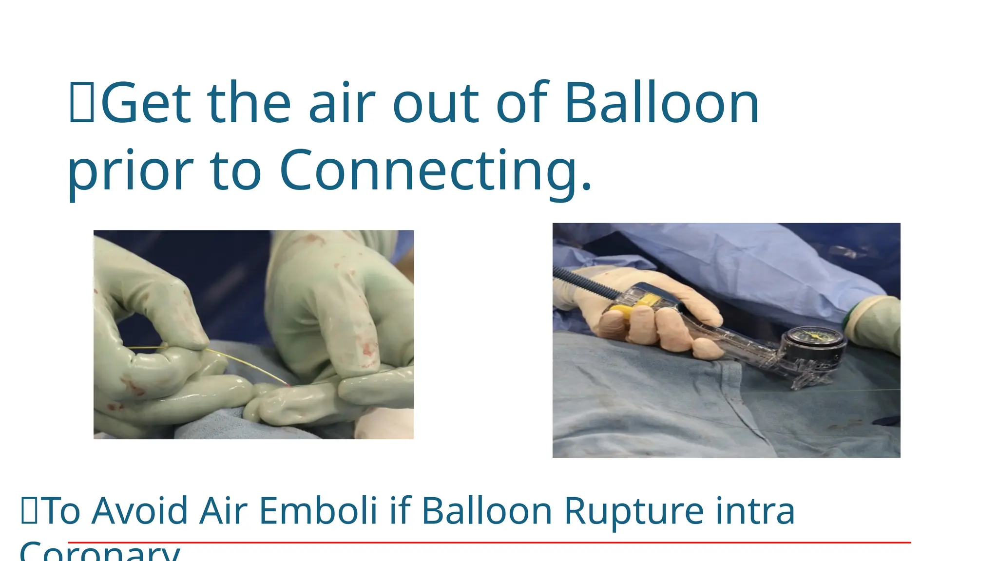 Balloon Angioplasty Basics (Ahmed AlRefaiy). | PPTX