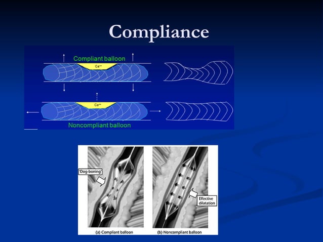 Coronary Balloons in various cardiac interventions | PPSX | First Aid ...
