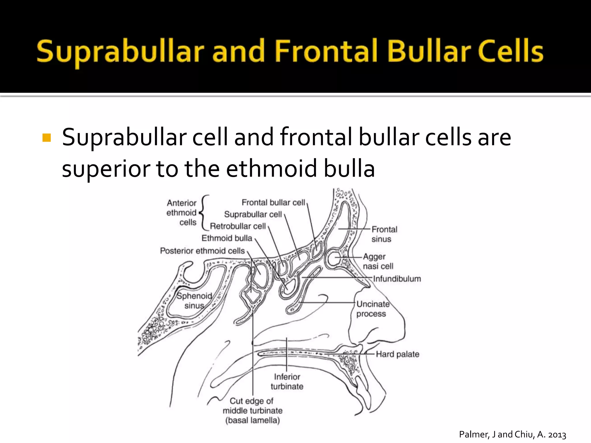 Balloon Sinuplasty: Pros and Cons | PPTX
