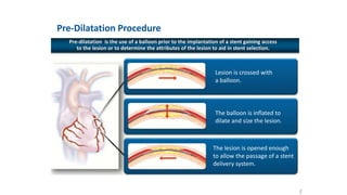balón coronario CARDIOLOGIA INTERVENCIONISTA | PPTX