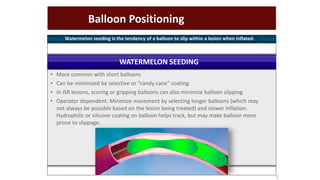 balón coronario CARDIOLOGIA INTERVENCIONISTA | PPTX