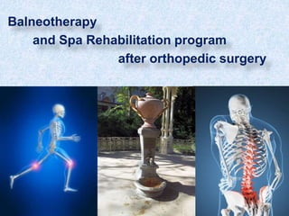 Balneotherapy and Spa Rehabilitation after Orthopedic surgery | PPT
