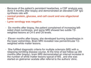 epidemiology and pathophysiology of multiple sclerosis | PPTX