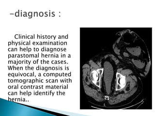 complications of colostomy | PPTX