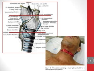 Balsenes traumas | PPT