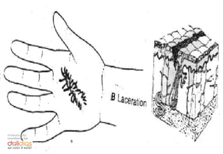 Balutan | PPT