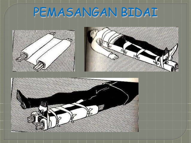 balut bidai.pptx