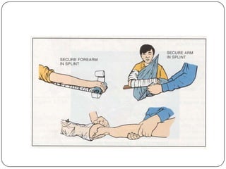 Dr Yuda Handaya SpB FInaCS,FMAS | PPTX