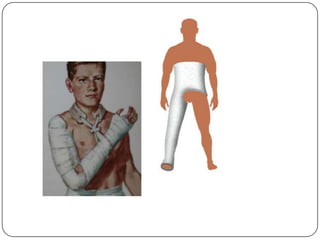 Dr Yuda Handaya SpB FInaCS,FMAS | PPTX