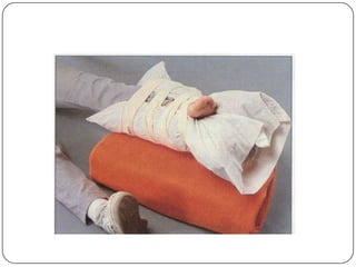 Dr Yuda Handaya SpB FInaCS,FMAS | PPTX