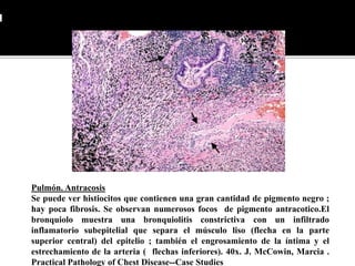 Banco imagenes patologia | PPTX