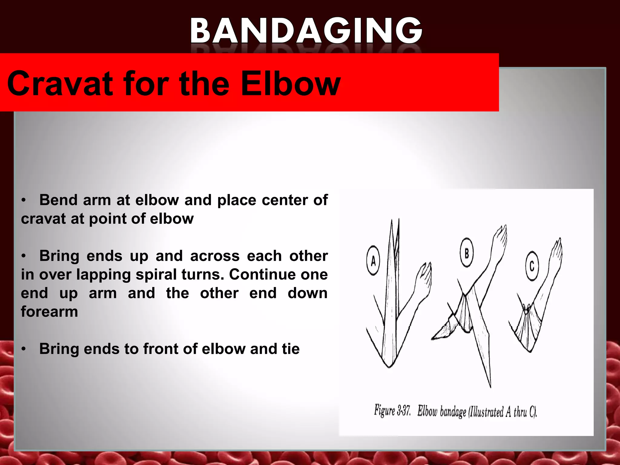 bandage.ppt