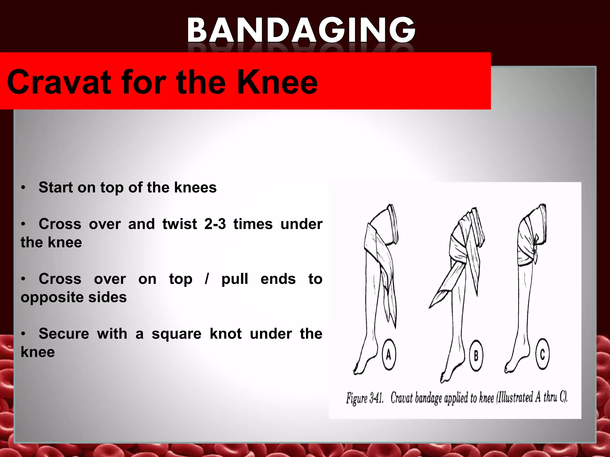 bandage.ppt