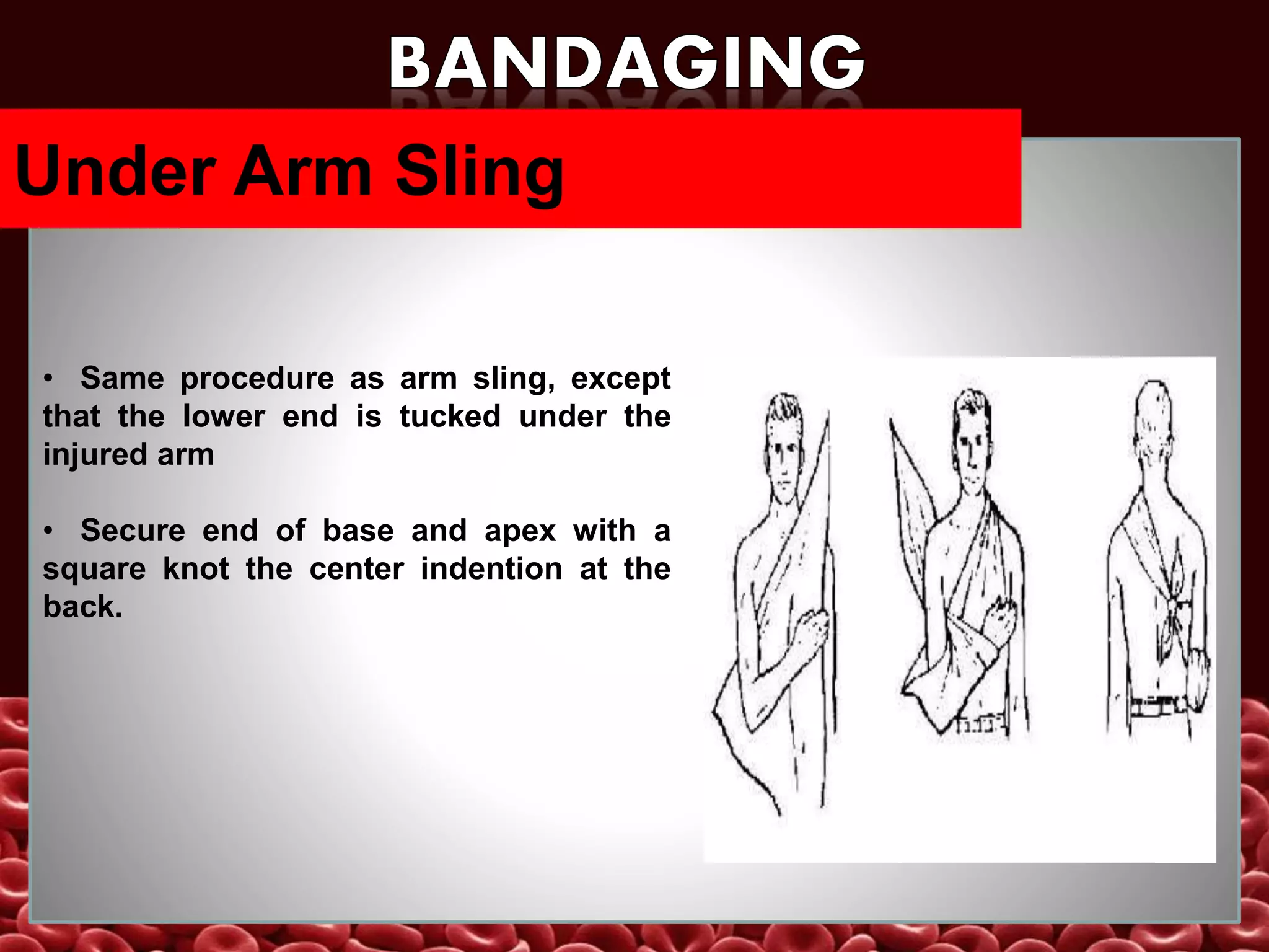 bandage.ppt