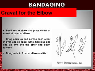 bandage.ppt