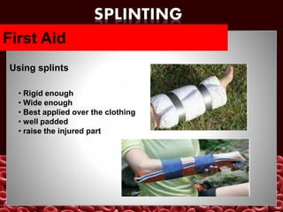 bandage.ppt