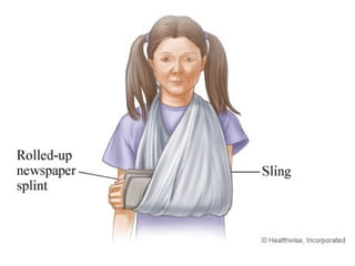 bandage procedure on a wound to prevent infection and control bleeding ...