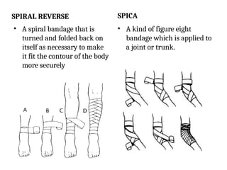 bandage procedure on a wound to prevent infection and control bleeding ...