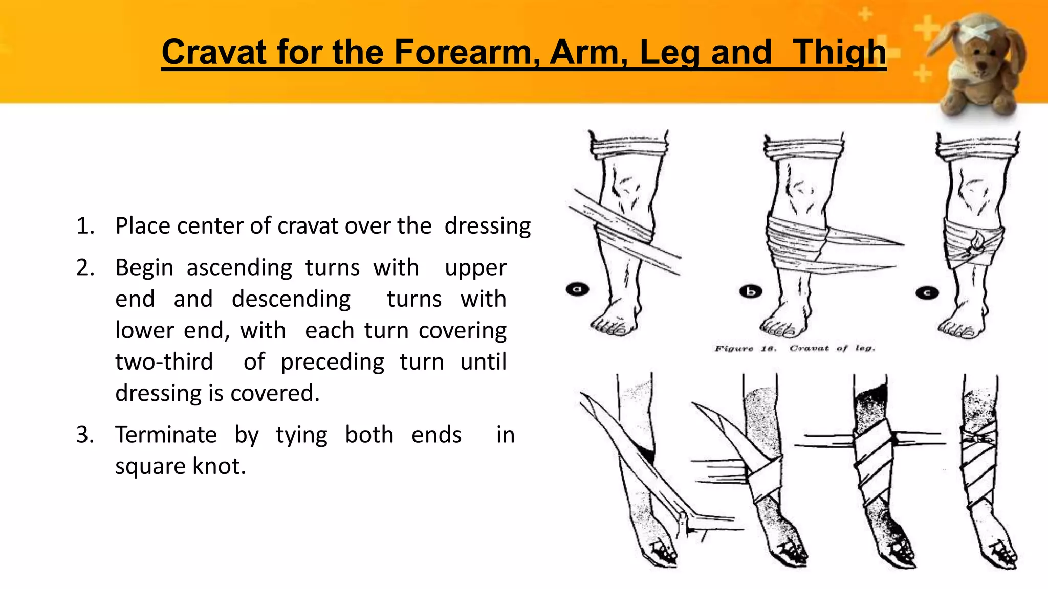 BANDAGING: TRIANGULAR BANDAGING AND CRAVAT, TYPES OF KNOTS | PPTX