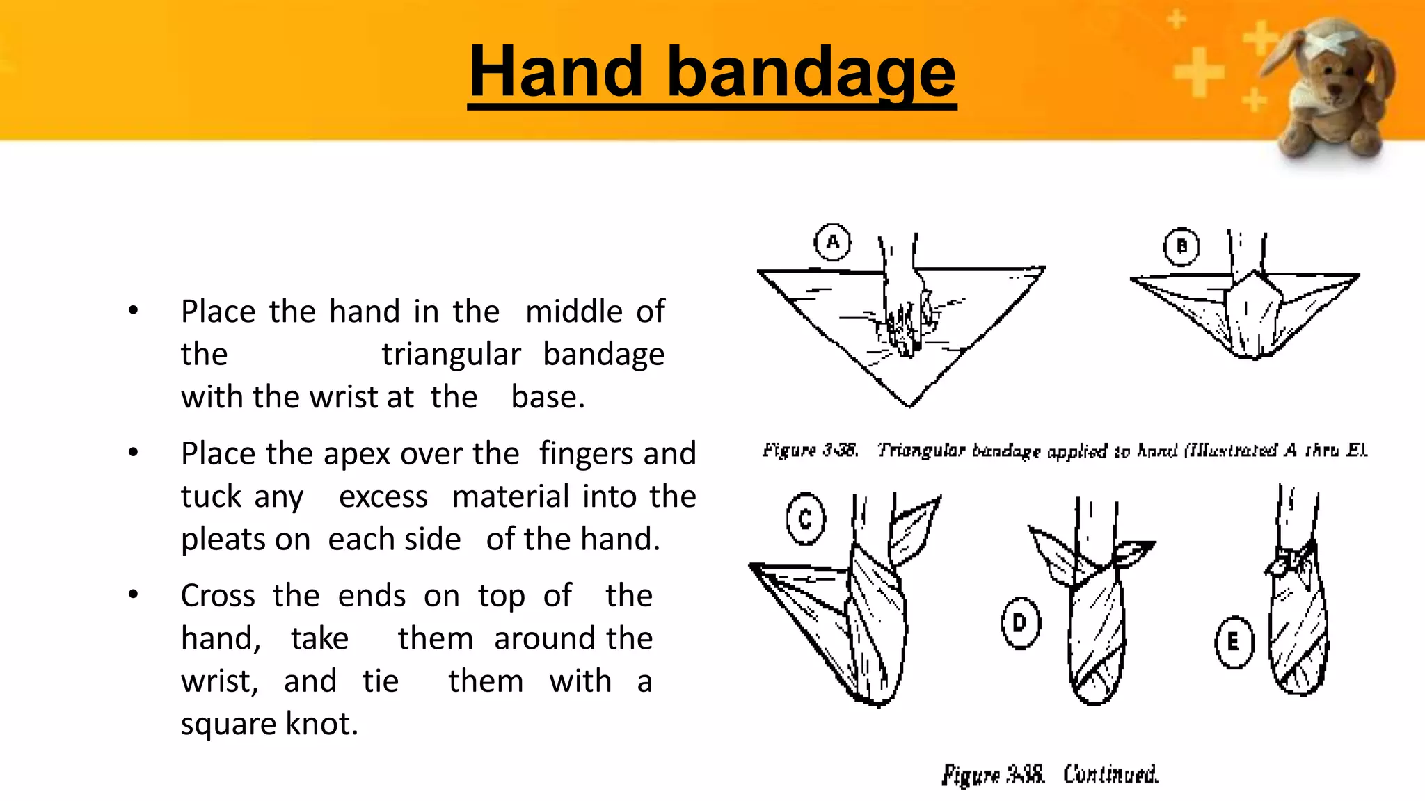 BANDAGING: TRIANGULAR BANDAGING AND CRAVAT, TYPES OF KNOTS | PPTX