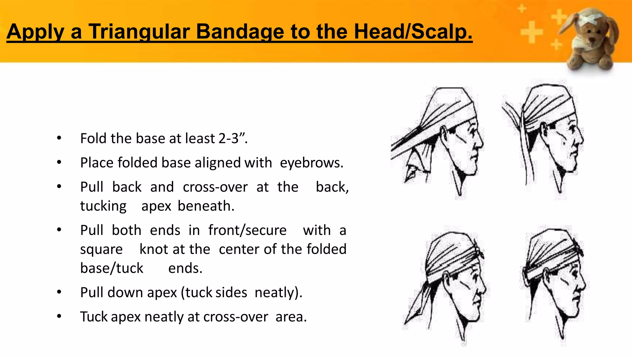BANDAGING: TRIANGULAR BANDAGING AND CRAVAT, TYPES OF KNOTS | PPTX