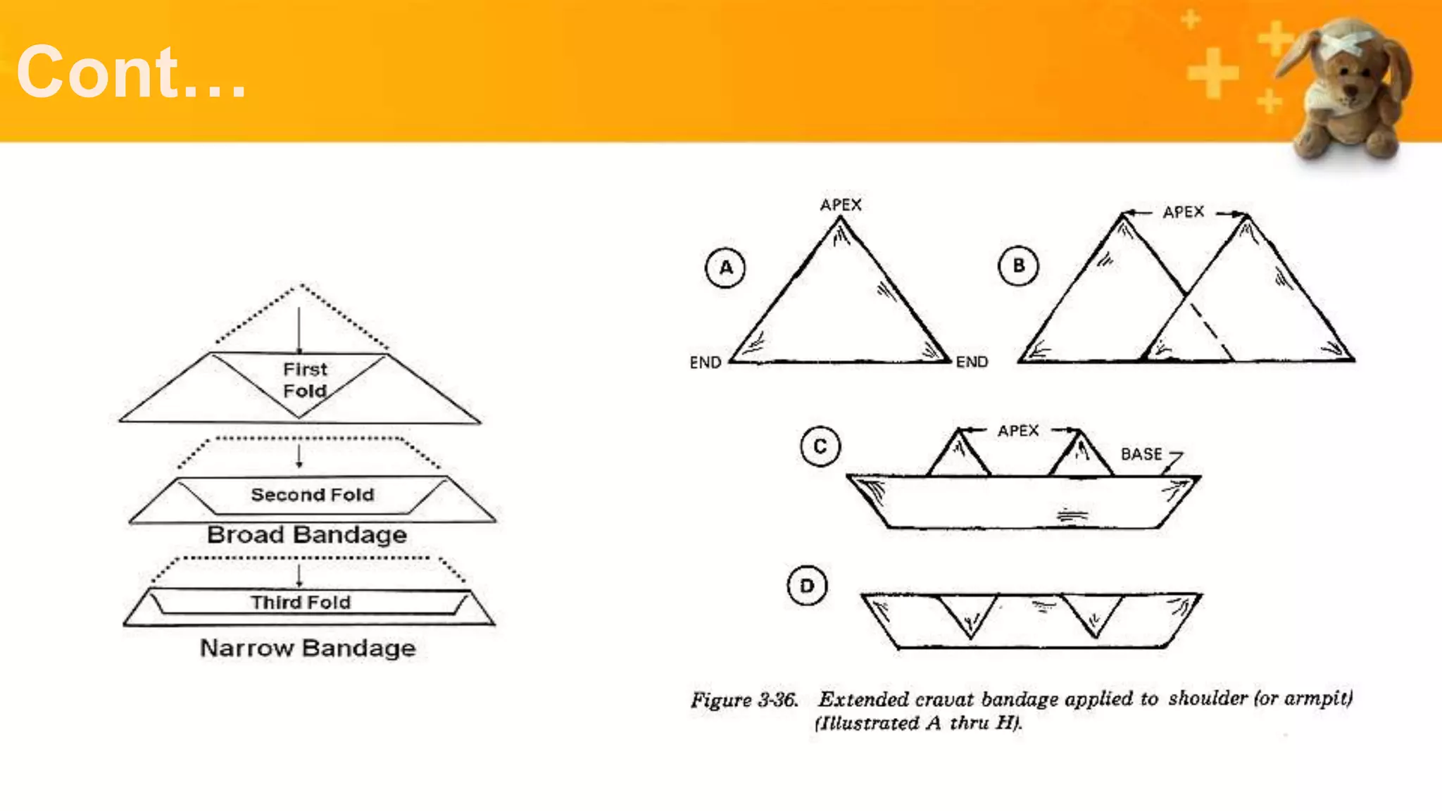 BANDAGING: TRIANGULAR BANDAGING AND CRAVAT, TYPES OF KNOTS | PPTX
