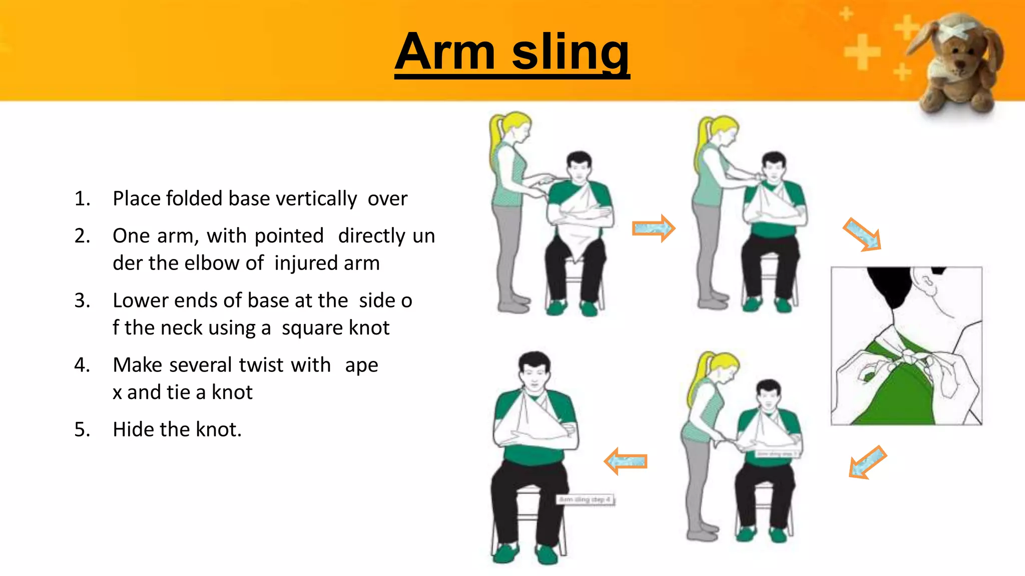 BANDAGING: TRIANGULAR BANDAGING AND CRAVAT, TYPES OF KNOTS | PPTX
