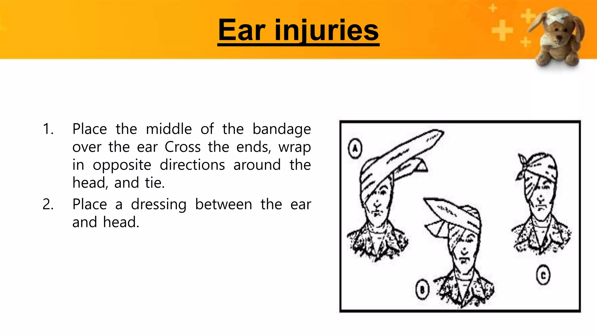 BANDAGING: TRIANGULAR BANDAGING AND CRAVAT, TYPES OF KNOTS | PPTX