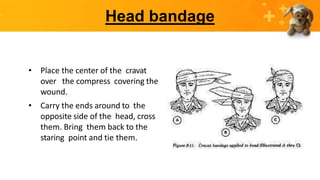 BANDAGING: TRIANGULAR BANDAGING AND CRAVAT, TYPES OF KNOTS | PPTX