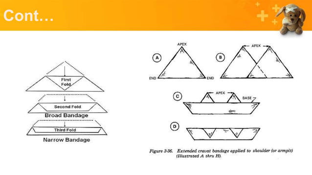 BANDAGING: TRIANGULAR BANDAGING AND CRAVAT, TYPES OF KNOTS | PPTX