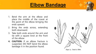 BANDAGING: TRIANGULAR BANDAGING AND CRAVAT, TYPES OF KNOTS | PPTX