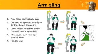 BANDAGING: TRIANGULAR BANDAGING AND CRAVAT, TYPES OF KNOTS | PPTX