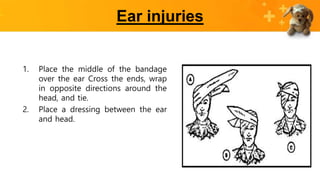 BANDAGING: TRIANGULAR BANDAGING AND CRAVAT, TYPES OF KNOTS | PPTX
